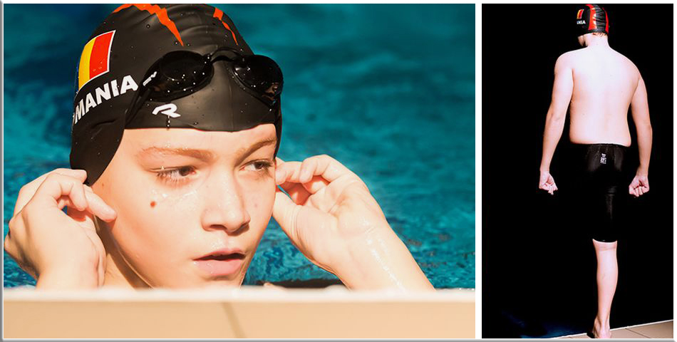 Arian are un picior amputat, dar nu se lasa! Care este visul lui VIDEO