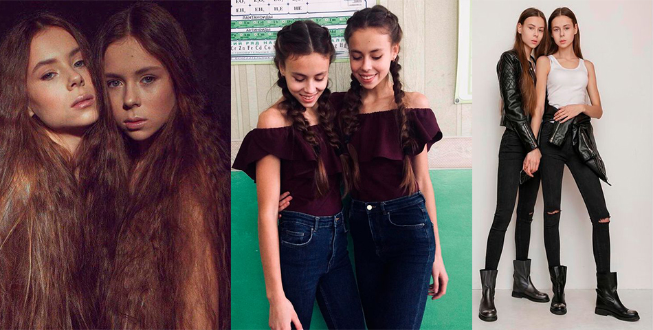 Gemenele numite 'scheleti vii' au devenit anorexice si sunt in pericol ...