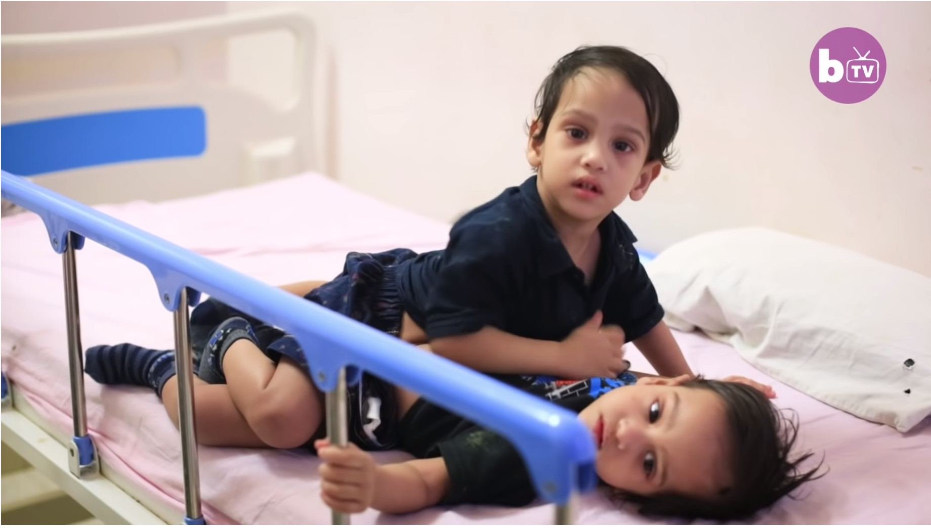 Gemenii lipiti care au fost separati prin operatie iar acum traiesc ...