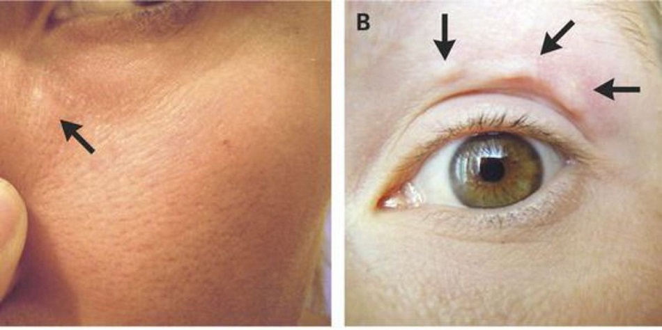 Umflatura care se misca pe chipul unei femei din Rusia!
