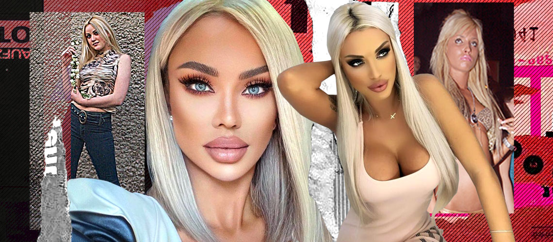 Before & After. Topul vedetelor din România care au și-au făcut buze XXL