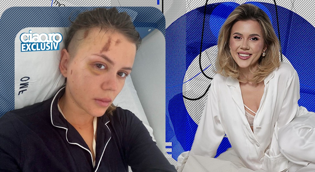 Emily Burghelea, detalii de ultimă oră după ce i-a fost scoasă tija din cap: "Am simțit ca și ...