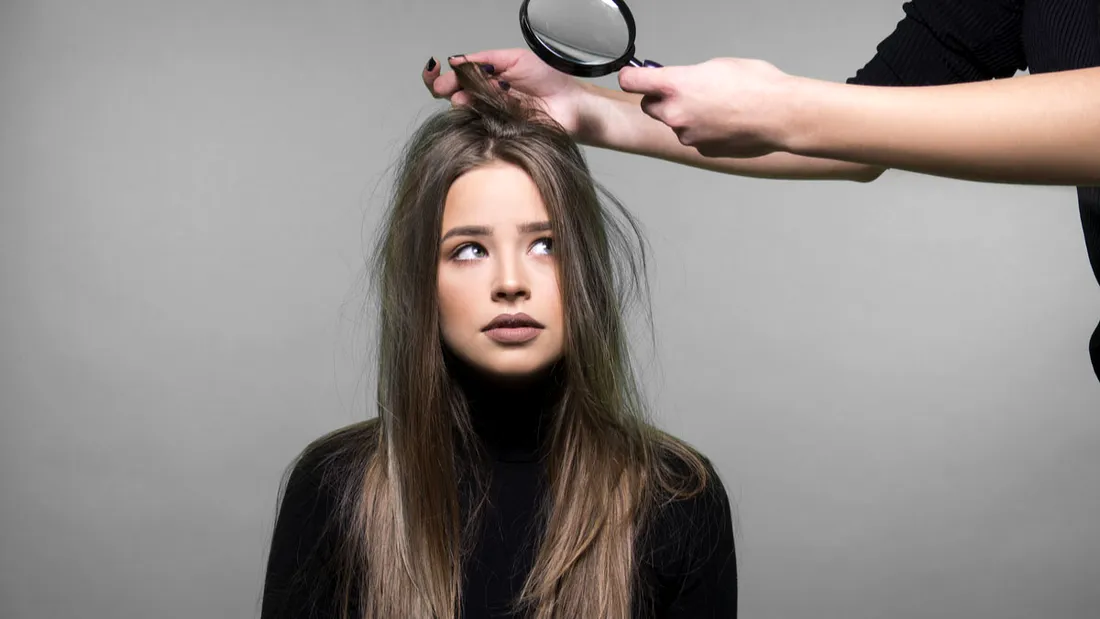 Remedii naturiste care te scapă de mătreață. Renunță la șampoanele scumpe!